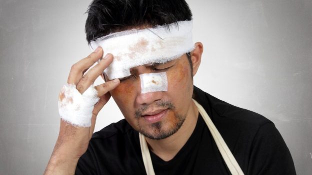 A Guide To Head Injury At Work Claims